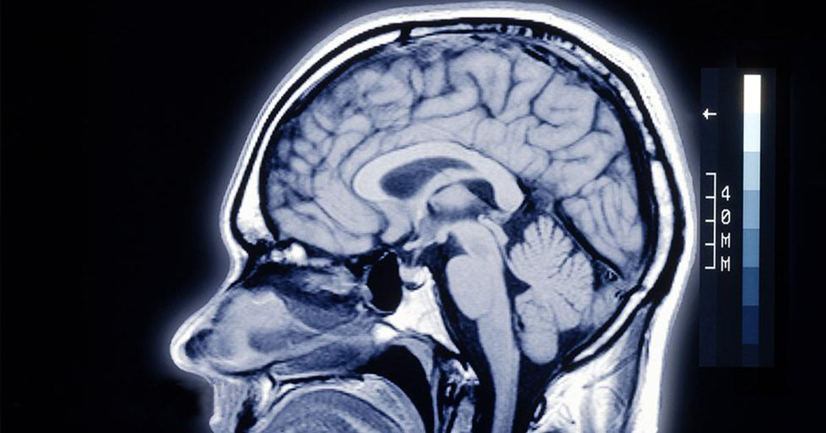 Life may actually flash before your eyes on death, study suggests